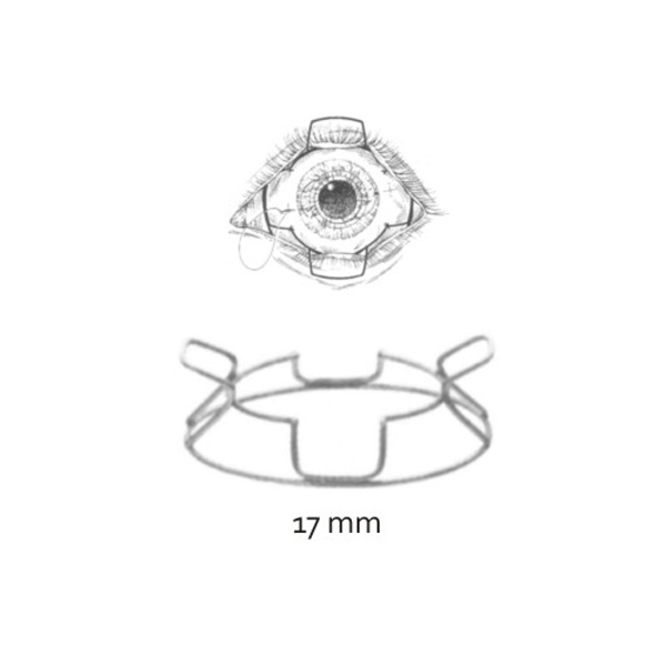 Fixation Rings